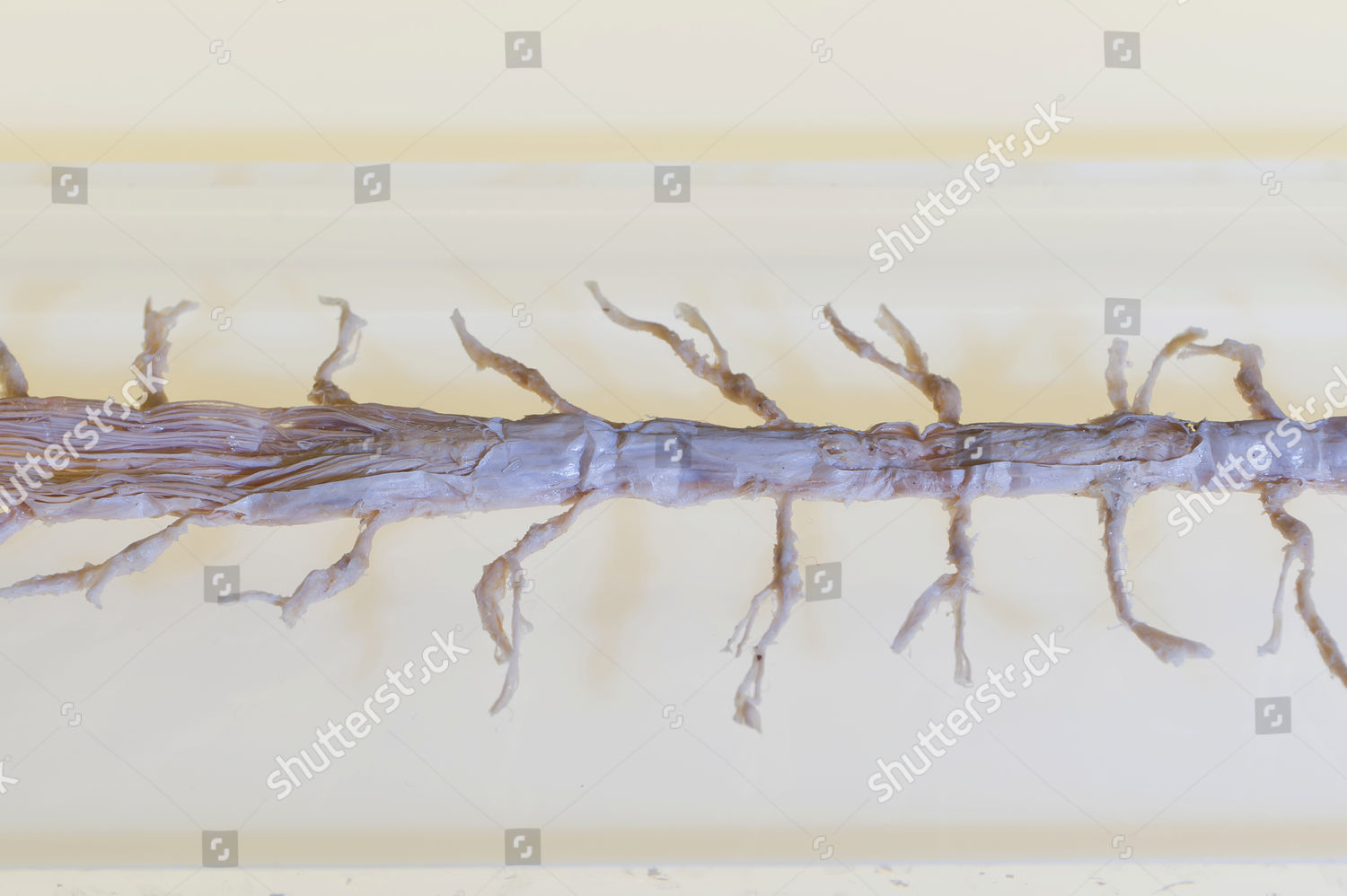 Plastination Specimen Spinal Cord Editorial Stock Photo - Stock Image ...
