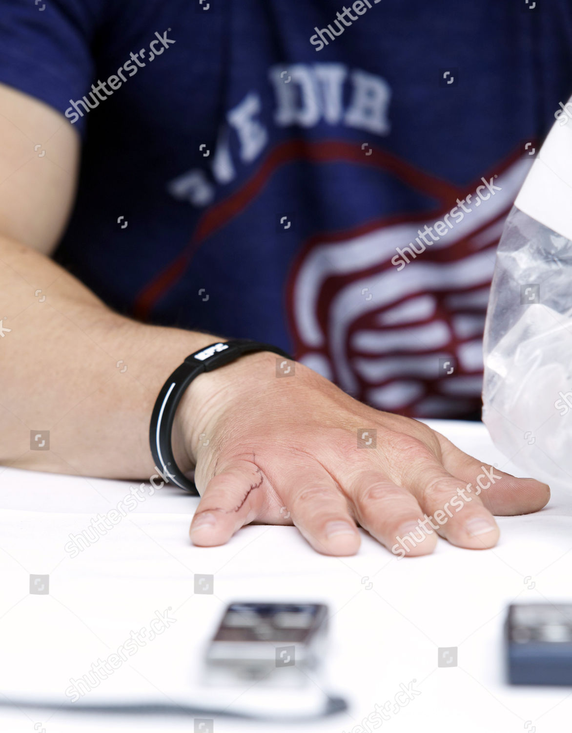 Mark Wahlberg Beestung Hand Editorial Stock Photo - Stock Image ...
