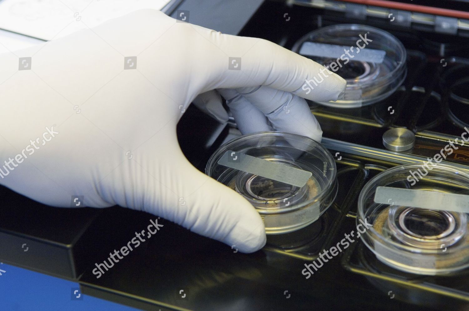 Doctors Hand Placing Fertilized Embryos Into Editorial Stock Photo ...