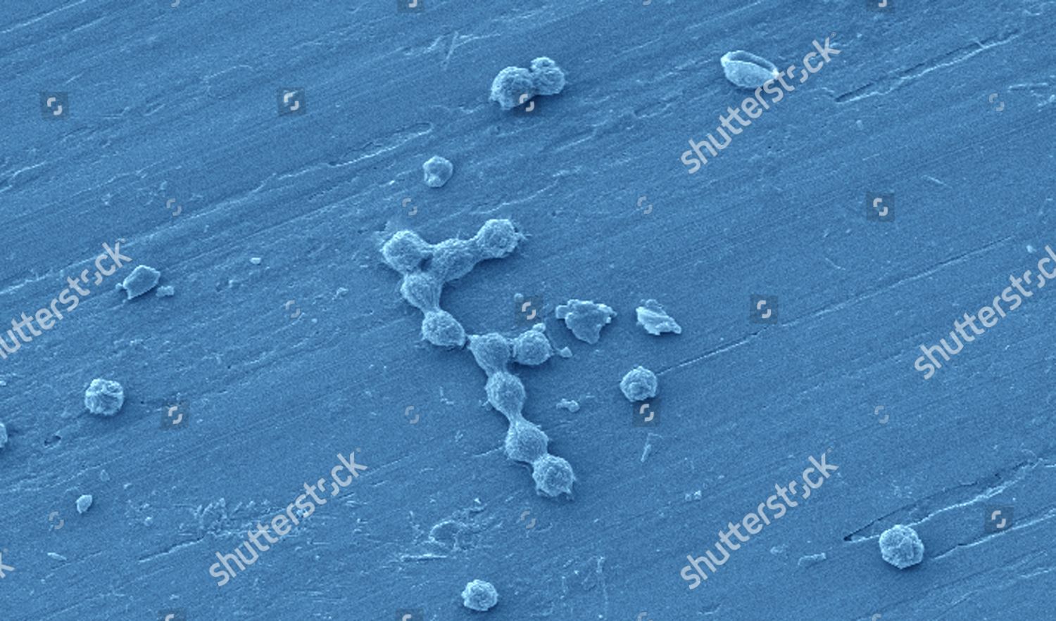 Hartmannella Vermiformis Editorial Stock Photo - Stock Image | Shutterstock