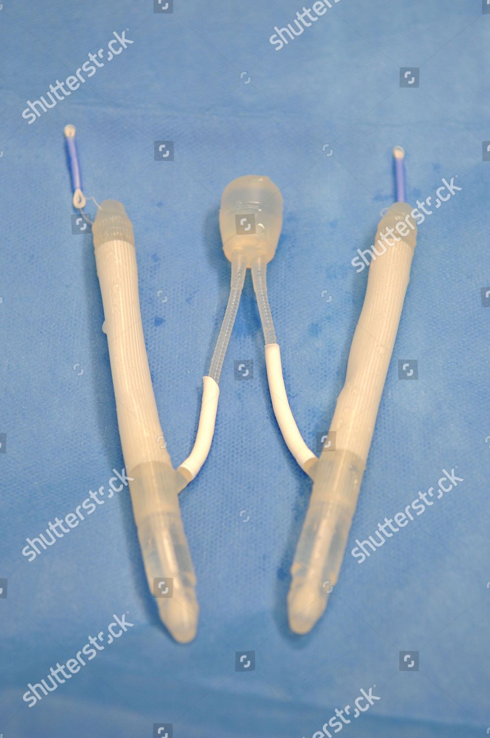 Phalloplasty Surgery Hospital Editorial Stock Photo - Stock Image ...