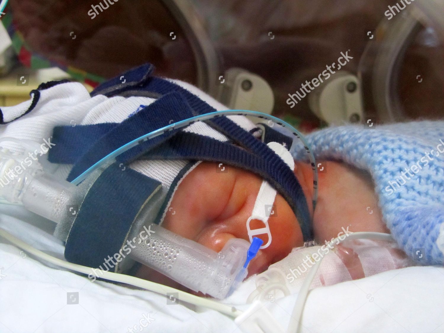Surrogate Baby Number 9 Jacob Born Editorial Stock Photo - Stock Image ...