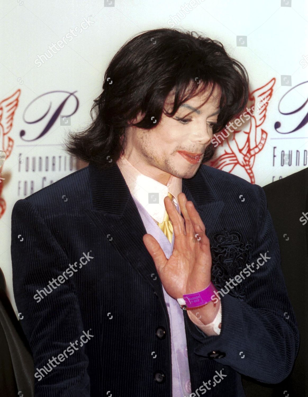 Michael Jackson Note Allergy Alert Wrist Editorial Stock Photo - Stock ...