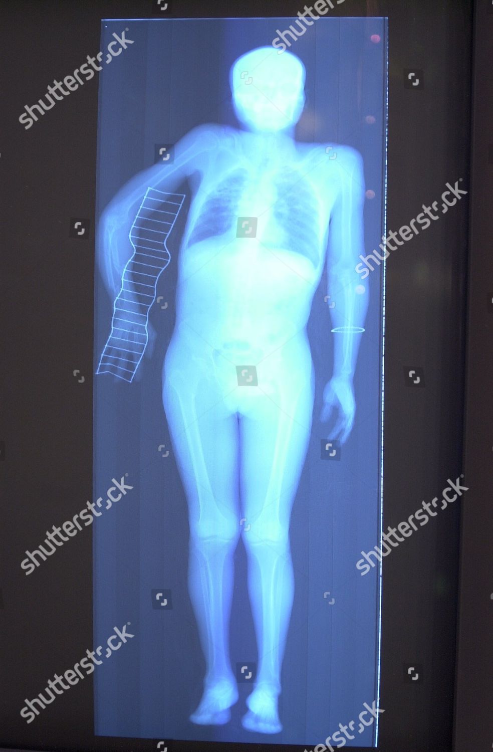 Full Body Xray Machine Editorial Stock Photo - Stock Image | Shutterstock