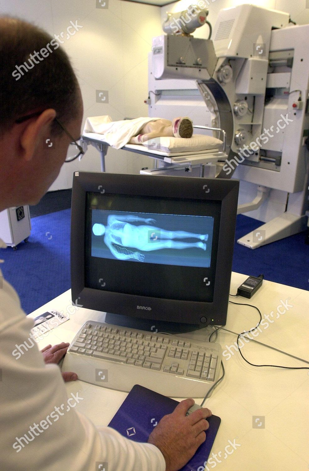 Full Body Xray Machine Editorial Stock Photo - Stock Image | Shutterstock