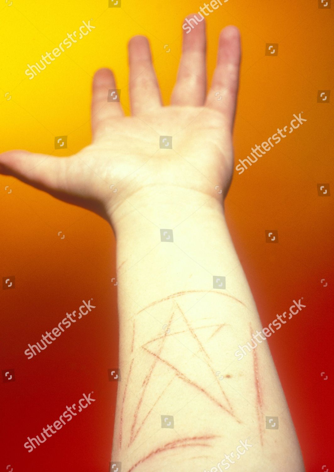 Self Harm Scars Person Star Scratched Editorial Stock Photo - Stock ...