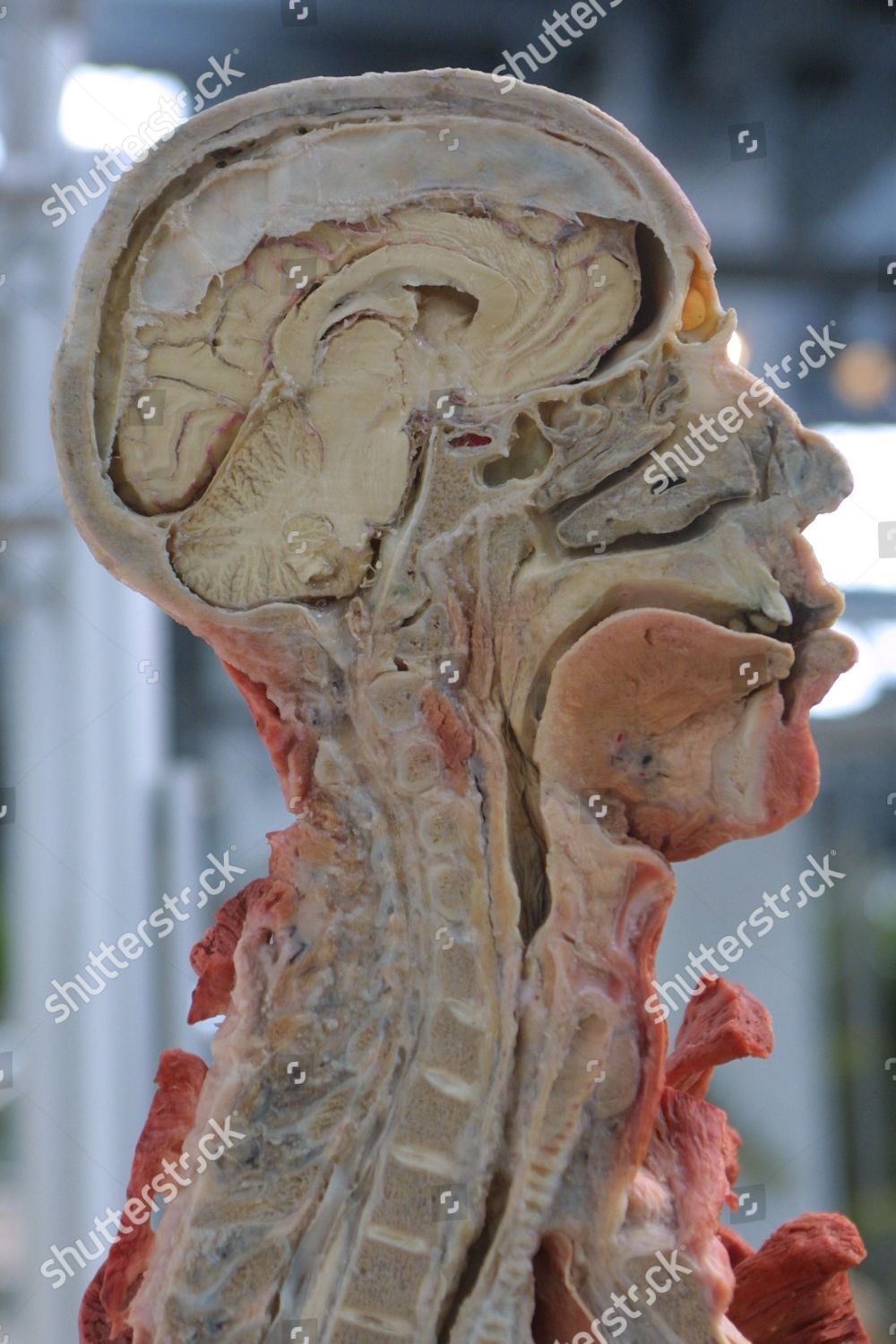 Real Human Body Body Worlds Editorial Stock Photo - Stock Image ...