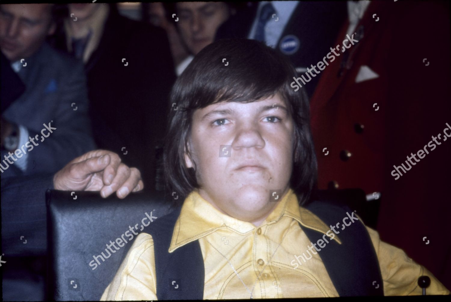 Eddie Freeman Thalidomide Boy Editorial Stock Photo - Stock Image ...
