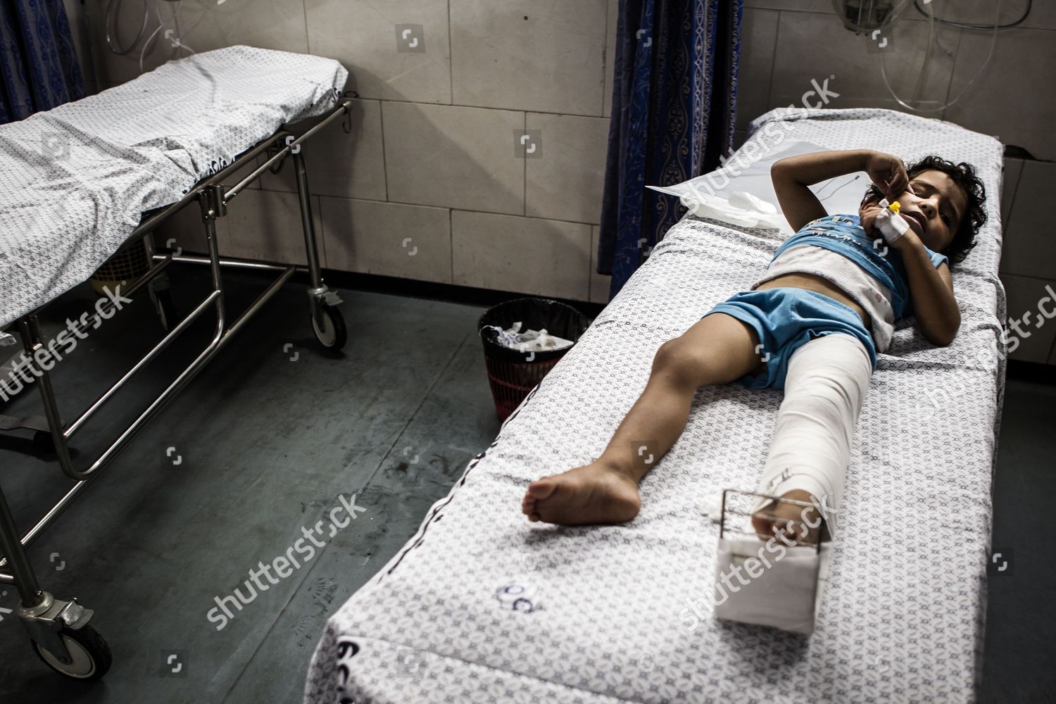 Young Boy Broken Leg Arrives Shifa Editorial Stock Photo - Stock Image ...