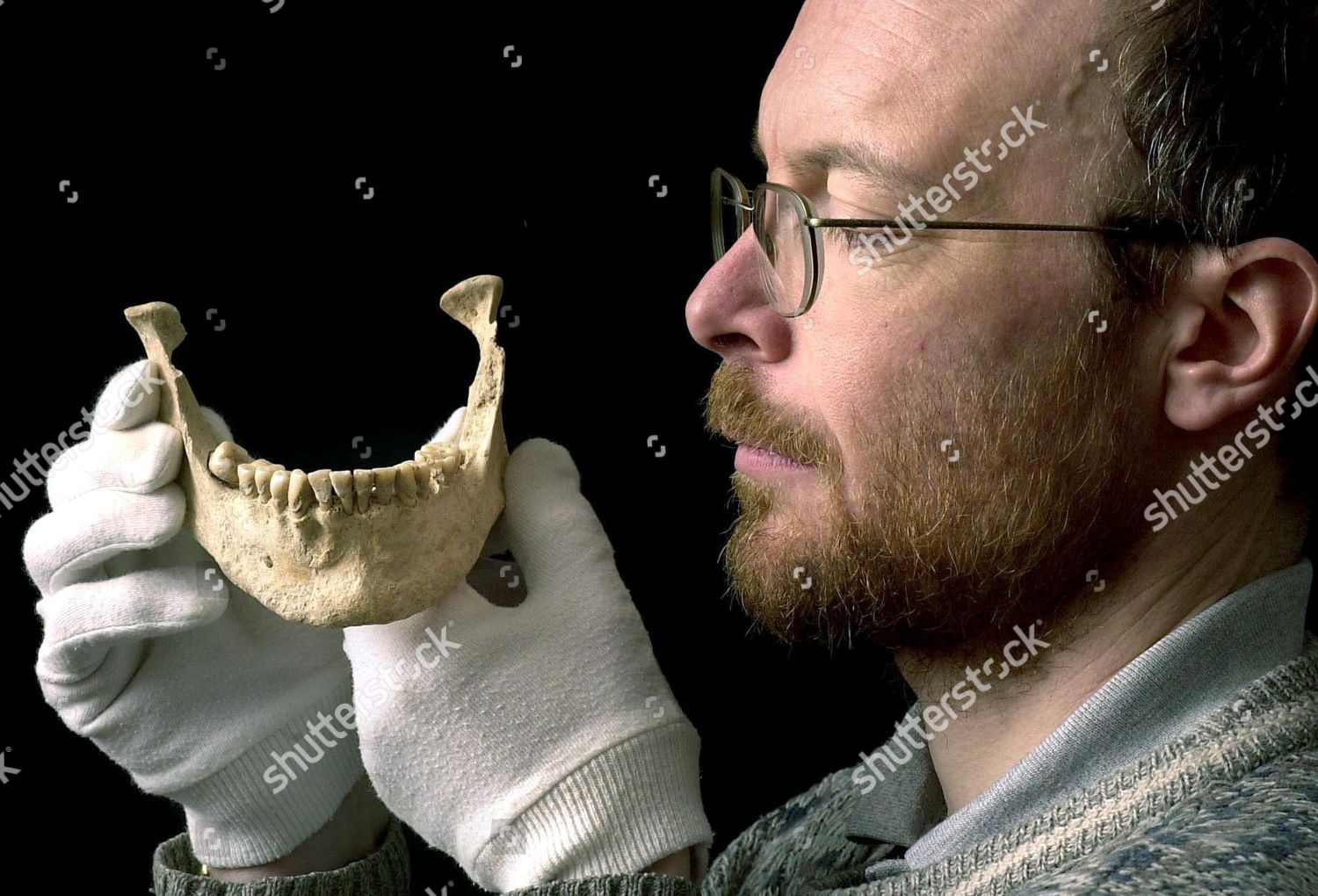 Dr Simon Mays English Heritage Skeletal Editorial Stock Photo - Stock ...
