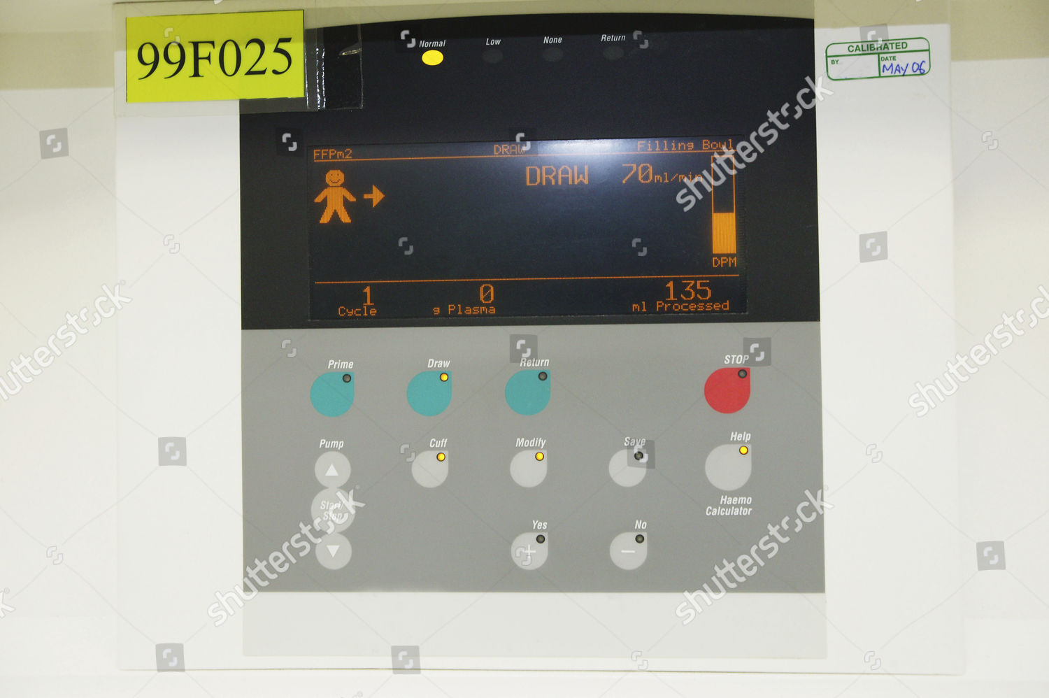 User Interface Haemonetics Mcs Blood Collection Editorial Stock Photo ...