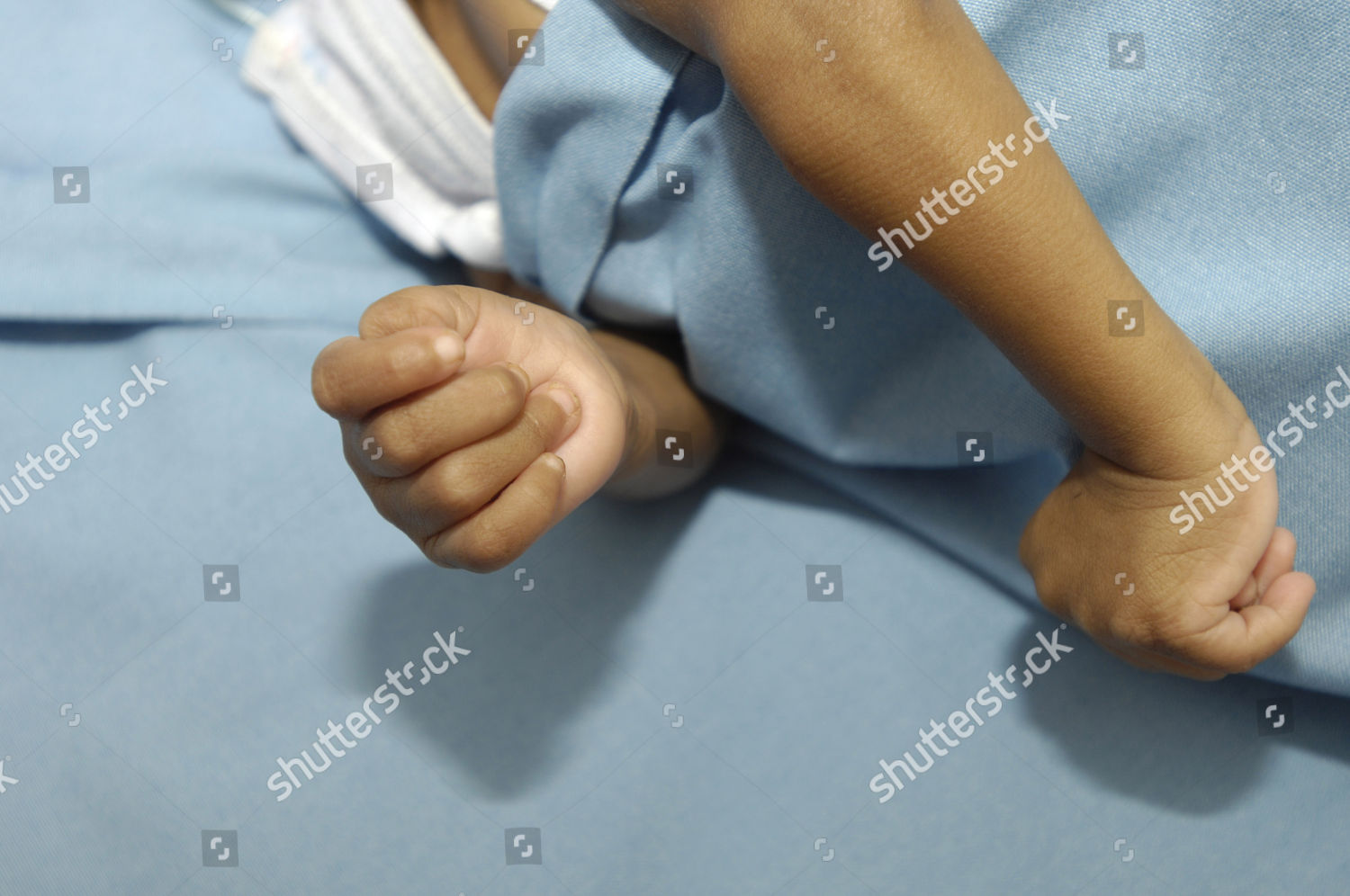 Model Released Cerebral Palsy Disorder Movement Editorial Stock Photo ...