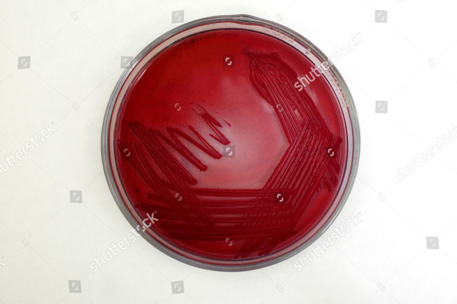 Ecoli Escherichia Coli O157h7 Sample Taken Editorial Stock Photo ...
