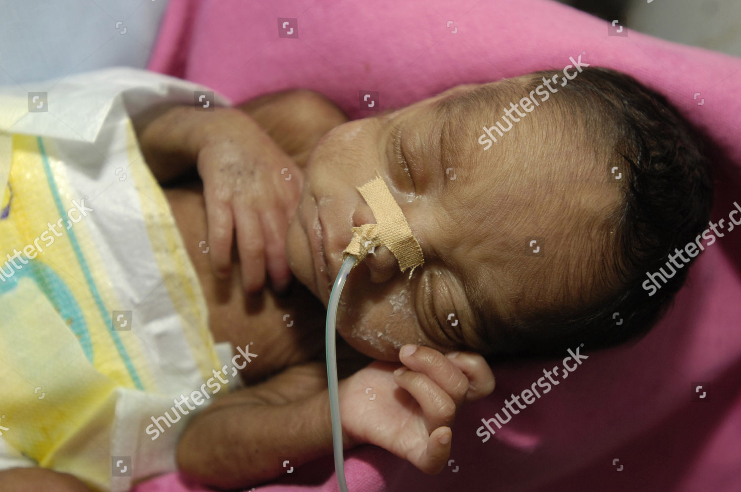 Premature Baby Incubator Neonatal Unit Hospital Editorial Stock Photo ...