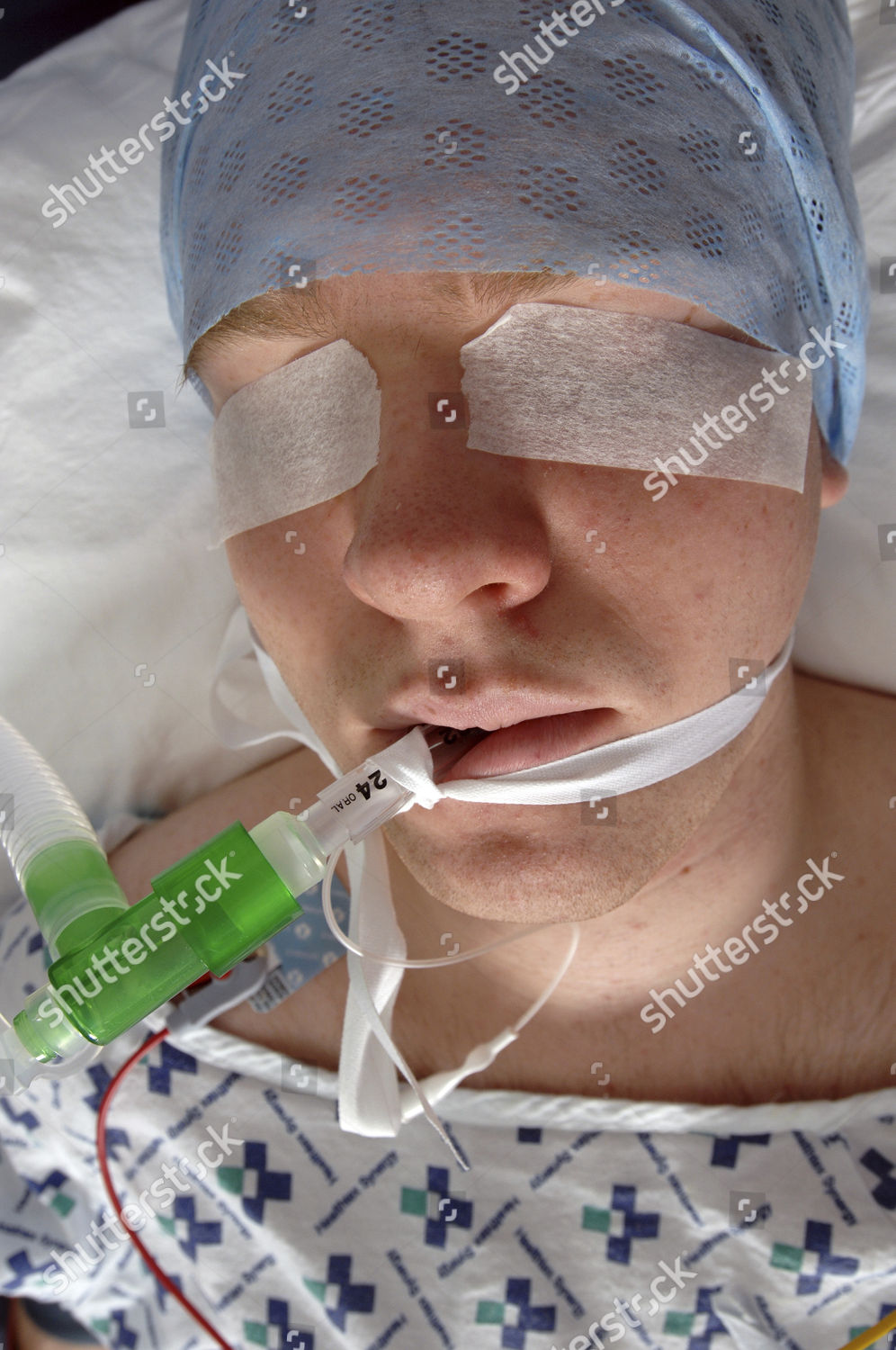 Close Face Anaesthetised Male Patient Editorial Stock Photo - Stock ...
