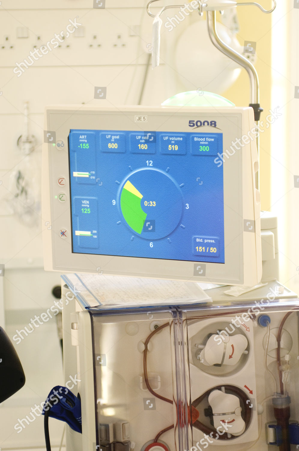 Hemodialysis Machine Which Connected Kidney Patient Editorial Stock ...