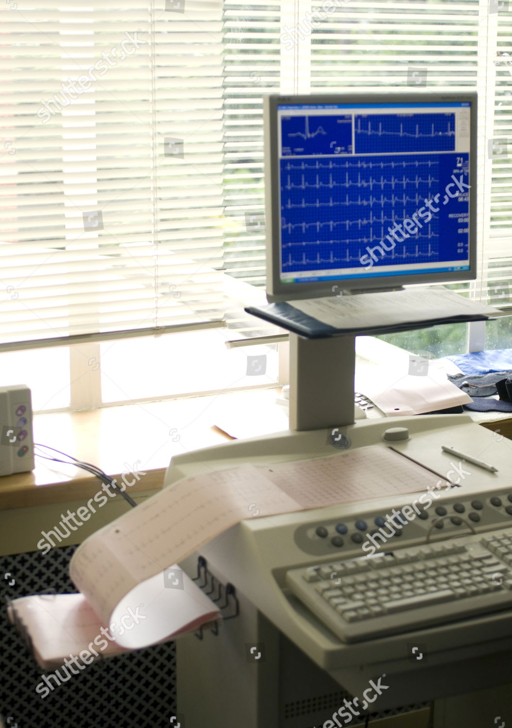 Electrocardiogram Recording Patients Cardiac Cycle Produced Editorial ...