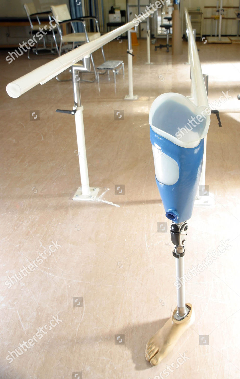 Above Knee Prosthesis Exercise Hand Rails Editorial Stock Photo - Stock ...