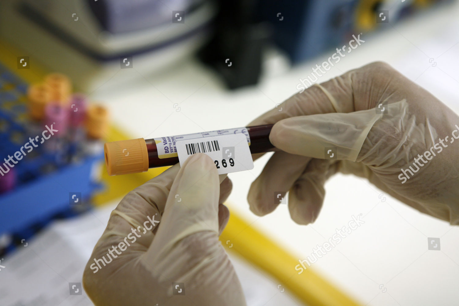 Pathologist Labels Blood Samples Test Tube Editorial Stock Photo ...