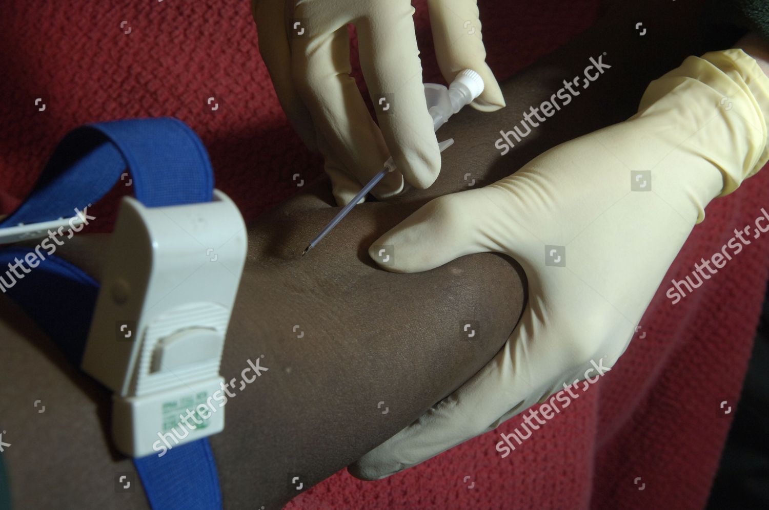 Paramedic Inserting Intravenous Catheter Into Patients Editorial Stock ...