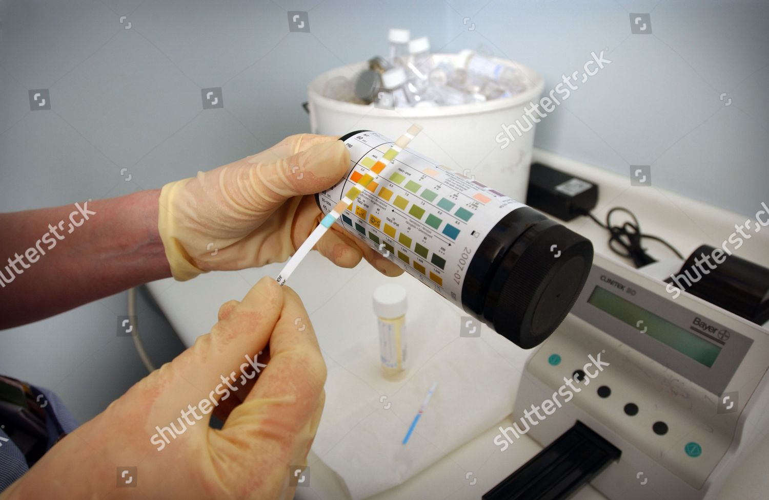 Nurse Uses Multistix Multiple Stick Test Editorial Stock Photo - Stock ...