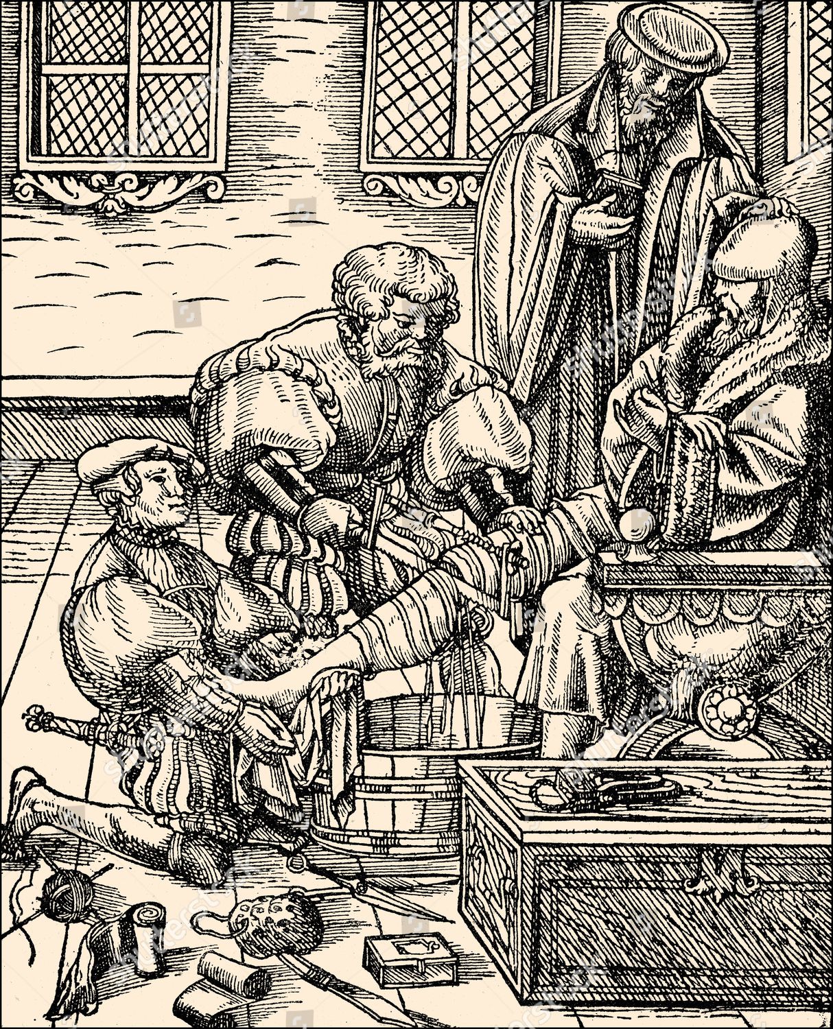Amputation Leg 16th Century Historical Illustration Editorial Stock ...