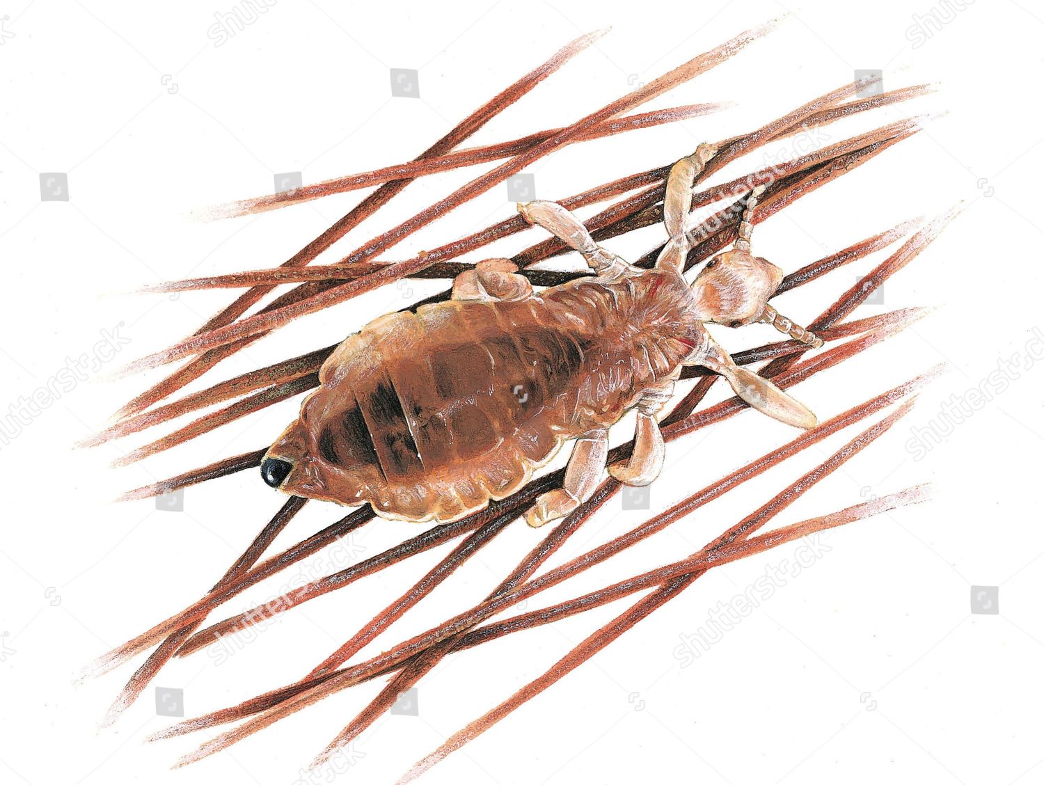 Illustration Headlouse Wingless Insect Living On Editorial Stock Photo ...