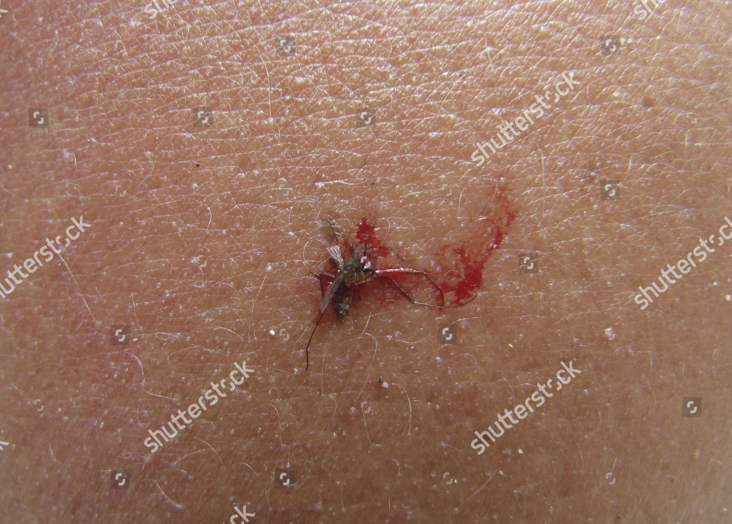 Dead Mosquito Culicidae Squashed On Human Editorial Stock Photo - Stock ...