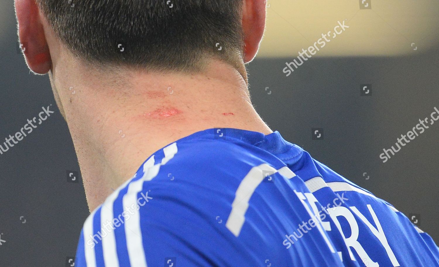 Scratches On Neck John Terry Chelsea Editorial Stock Photo - Stock ...
