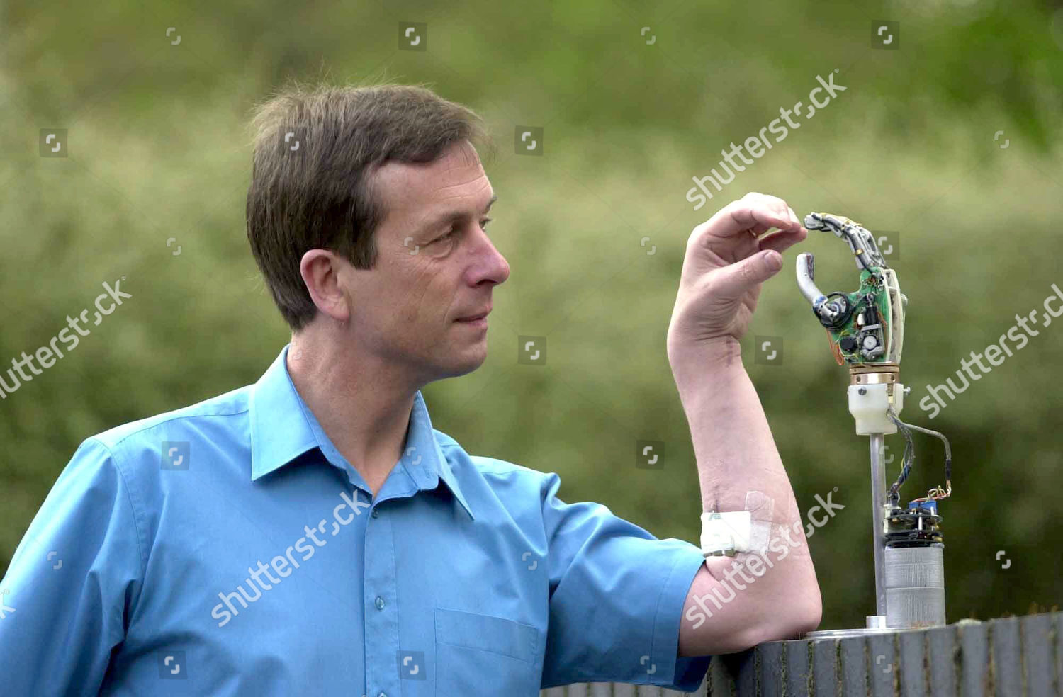 Professor Kevin Warwick His Cybernetic Arm Editorial Stock Photo ...