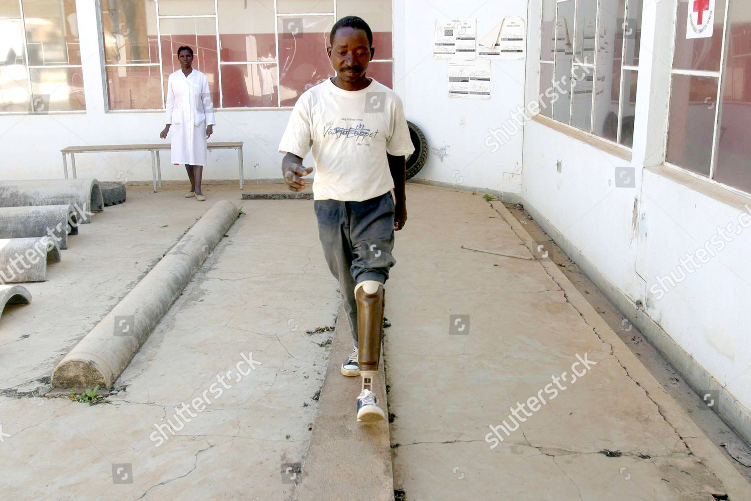 Amputee Mine Victim Bomba Alta Orthopaedic Editorial Stock Photo ...