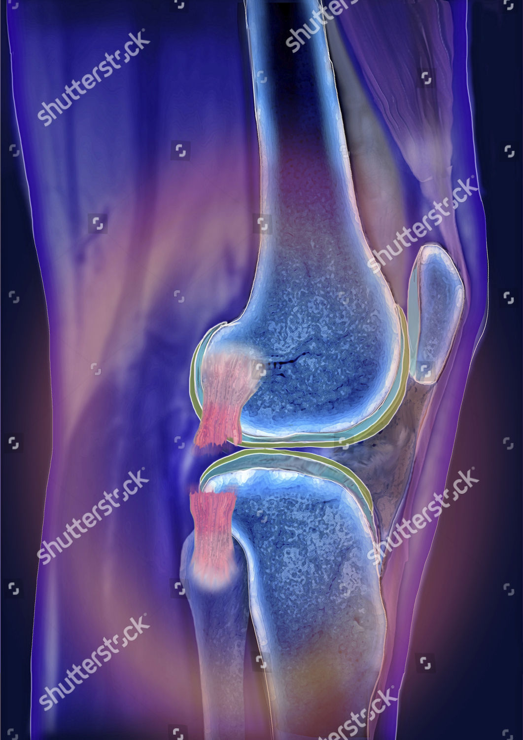 Knee Joint Articulatio Genus Lateral Collateral Editorial Stock Photo ...