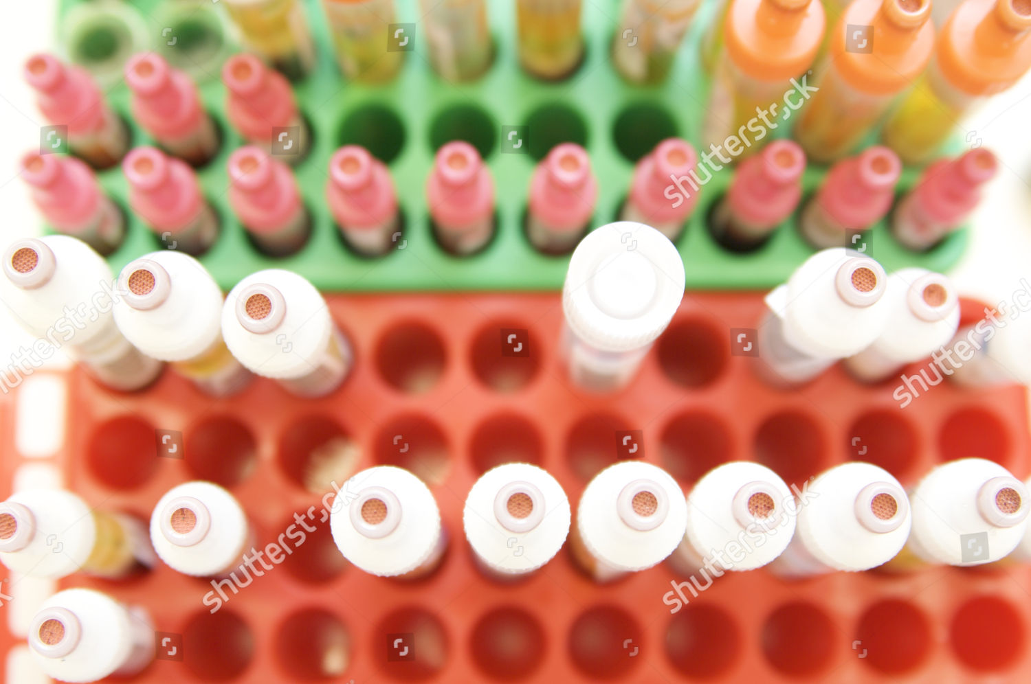 Stands Tubes Blood Laboratory Editorial Stock Photo - Stock Image ...