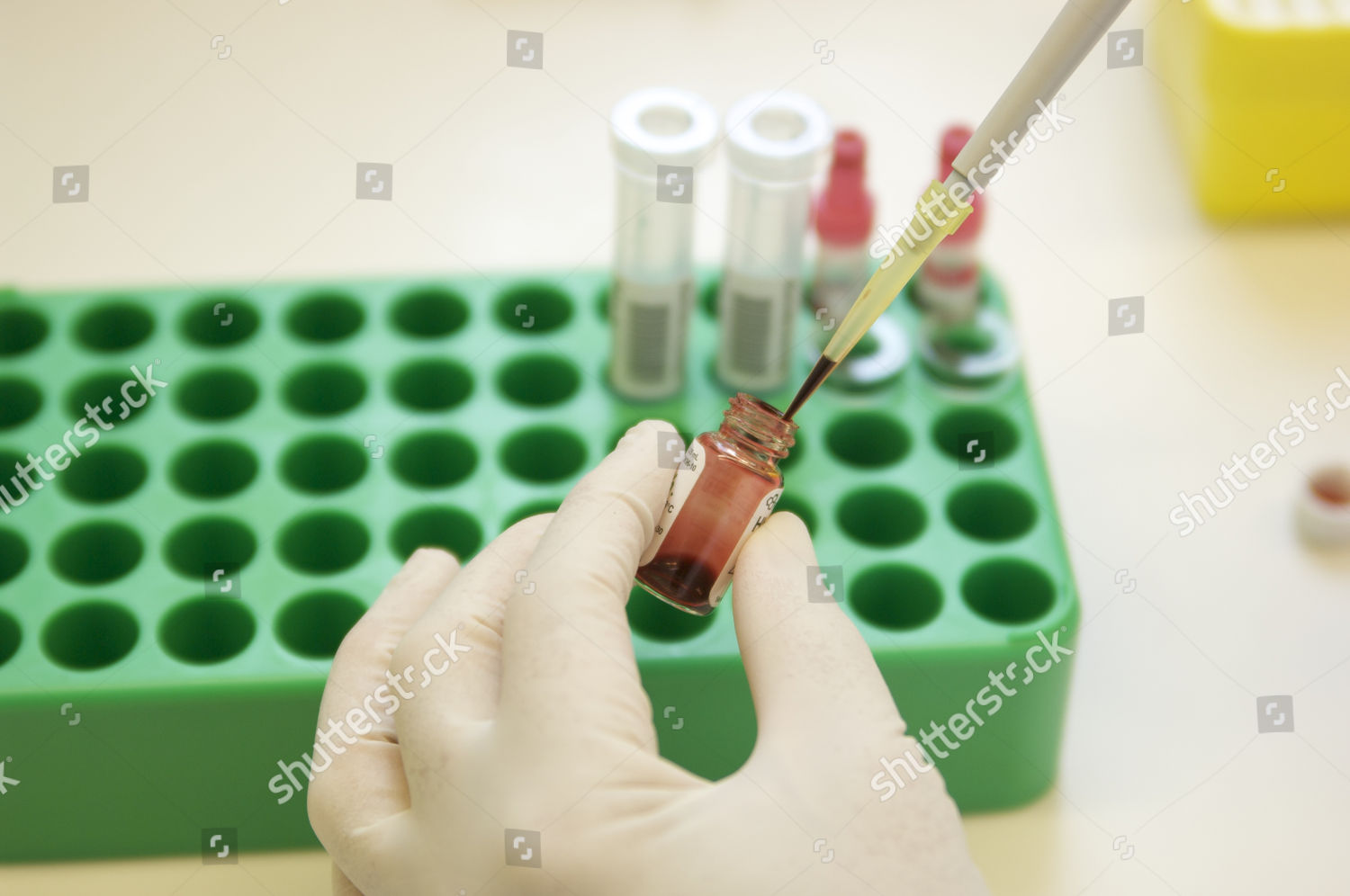 Hand Sterile Glove Pipetting Pipettor Laboratory Editorial Stock Photo ...