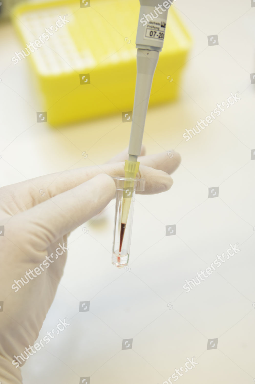 Hand Sterile Glove Pipetting Pipettor Laboratory Editorial Stock Photo ...