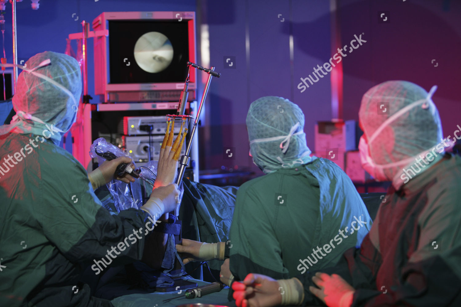 Arthroscopic Surgery Wrist Surgeon Sees Joint Editorial Stock Photo ...