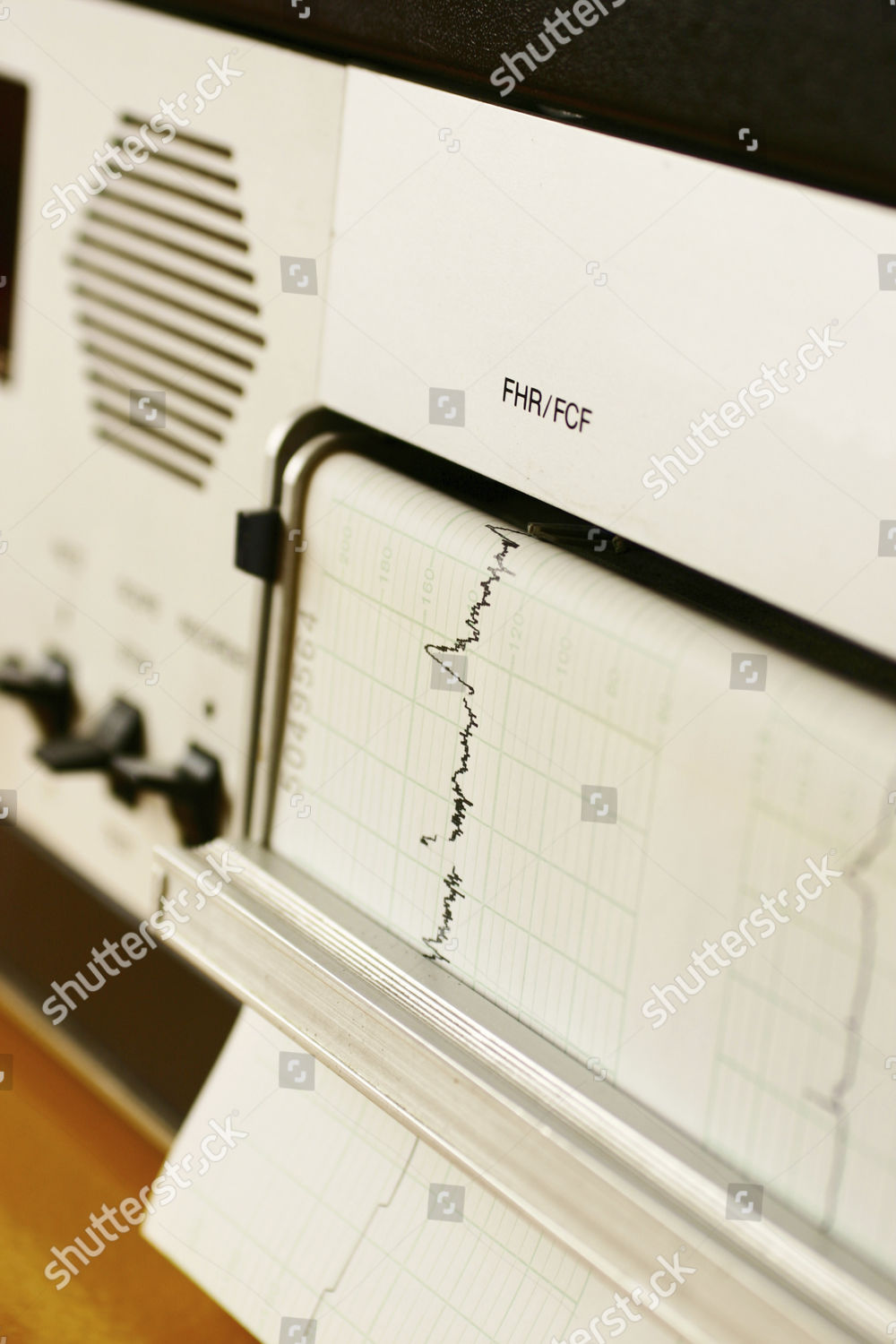 Cardiotocograph Ctg Heart Sound Chart Unborn Editorial Stock Photo ...