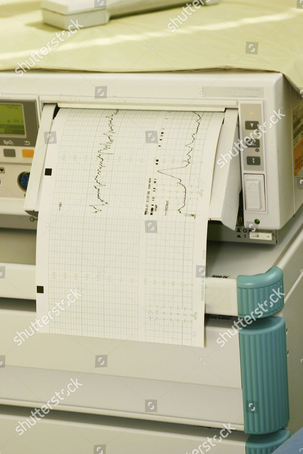 Cardiotocograph Ctg Heart Sound Chart Unborn Editorial Stock Photo ...