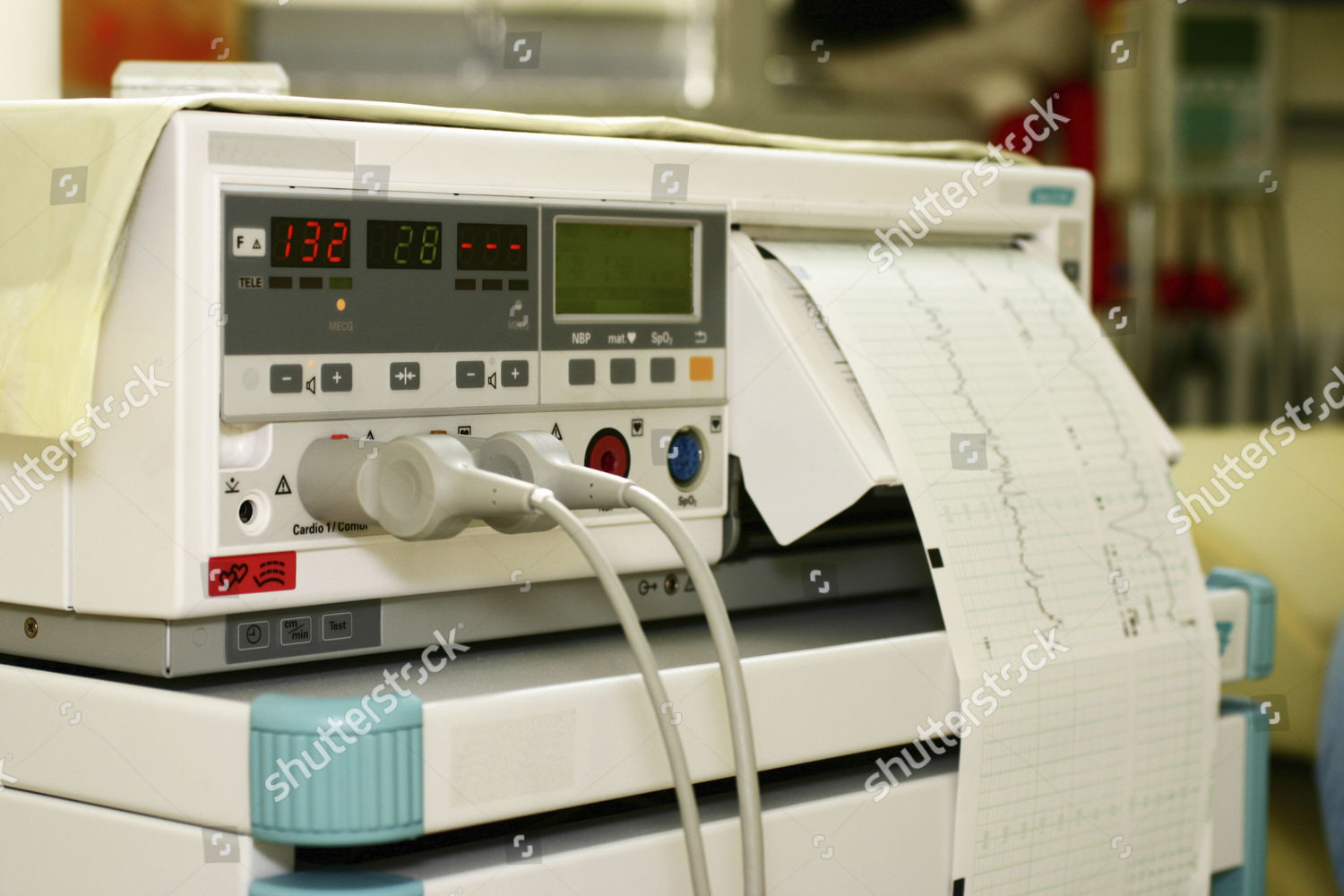 Cardiotocograph Ctg Editorial Stock Photo - Stock Image | Shutterstock