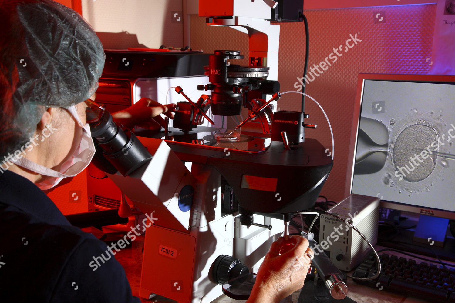Model Released Artificial Insemination Using Icsi Editorial Stock Photo ...