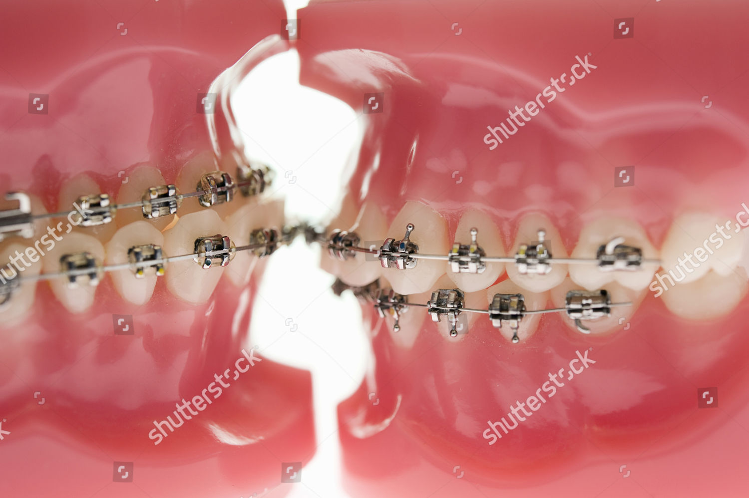 Two Models Teeth Facing Each Other Editorial Stock Photo - Stock Image ...