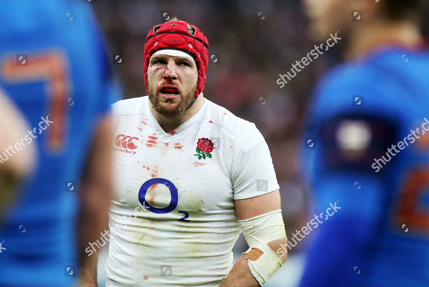 James Haskell Bloodied Face During Rbs Editorial Stock Photo - Stock ...
