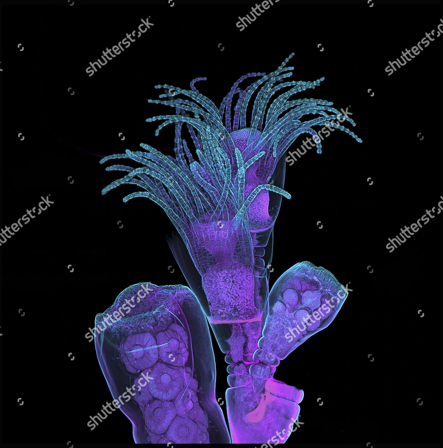 Confocal Microscope Image Polyps Colony Obelia Editorial Stock Photo ...