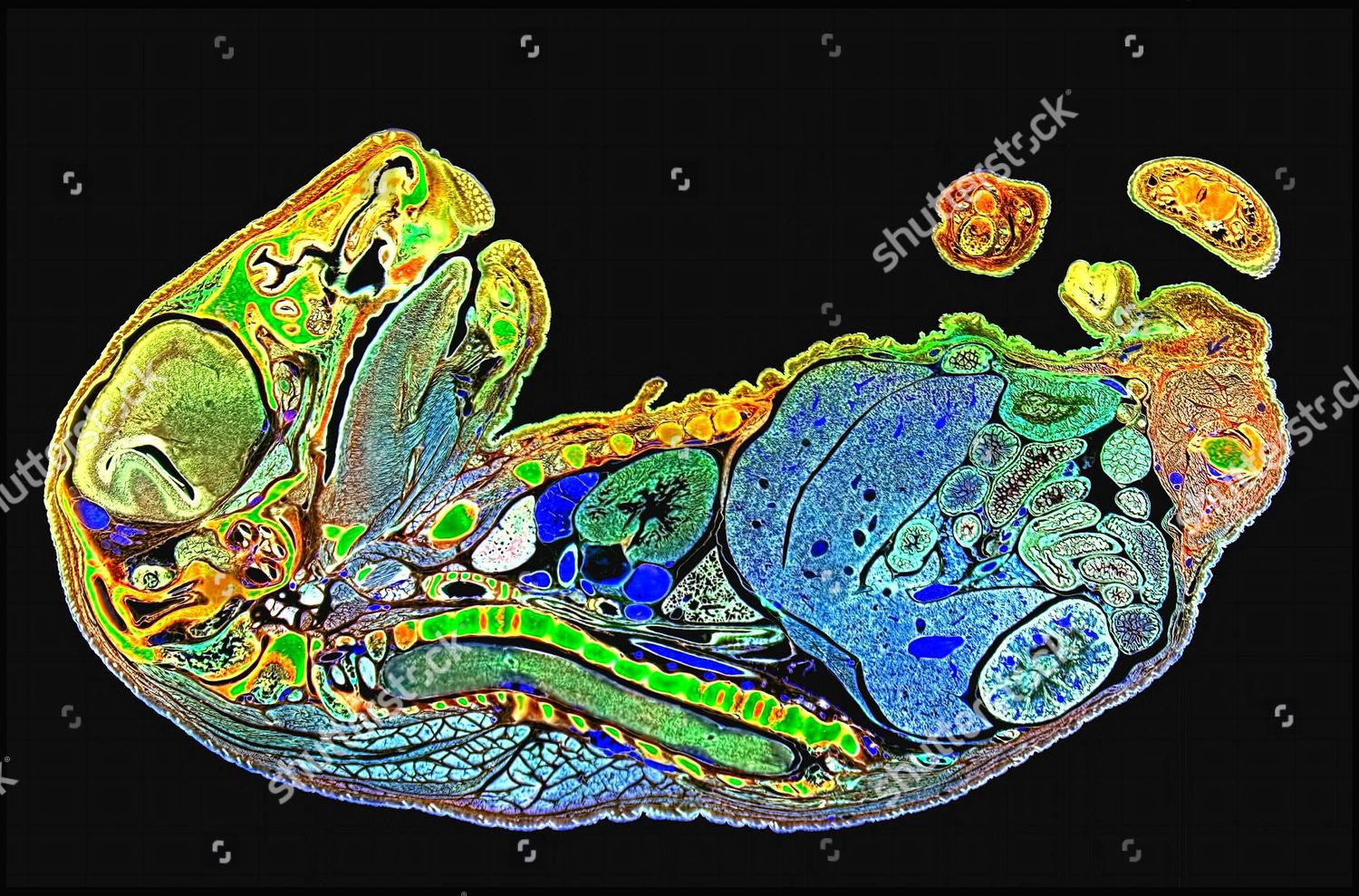Mouse Foetus Sagittal Longitudinal Section Editorial Stock Photo ...