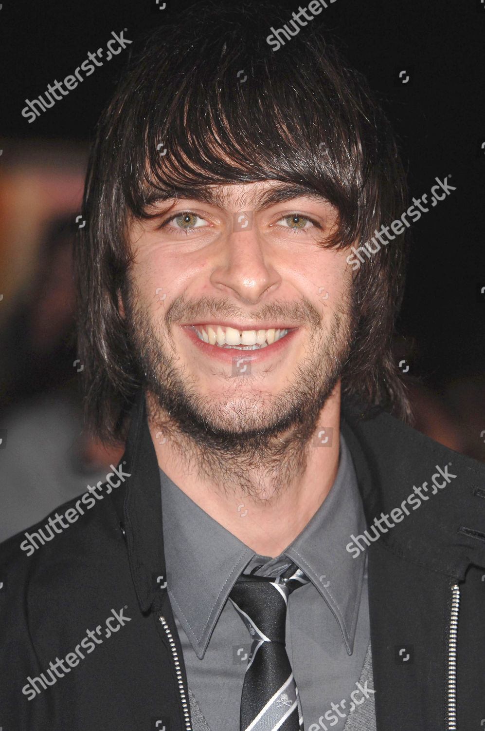 Joseph Gilgun Teeth