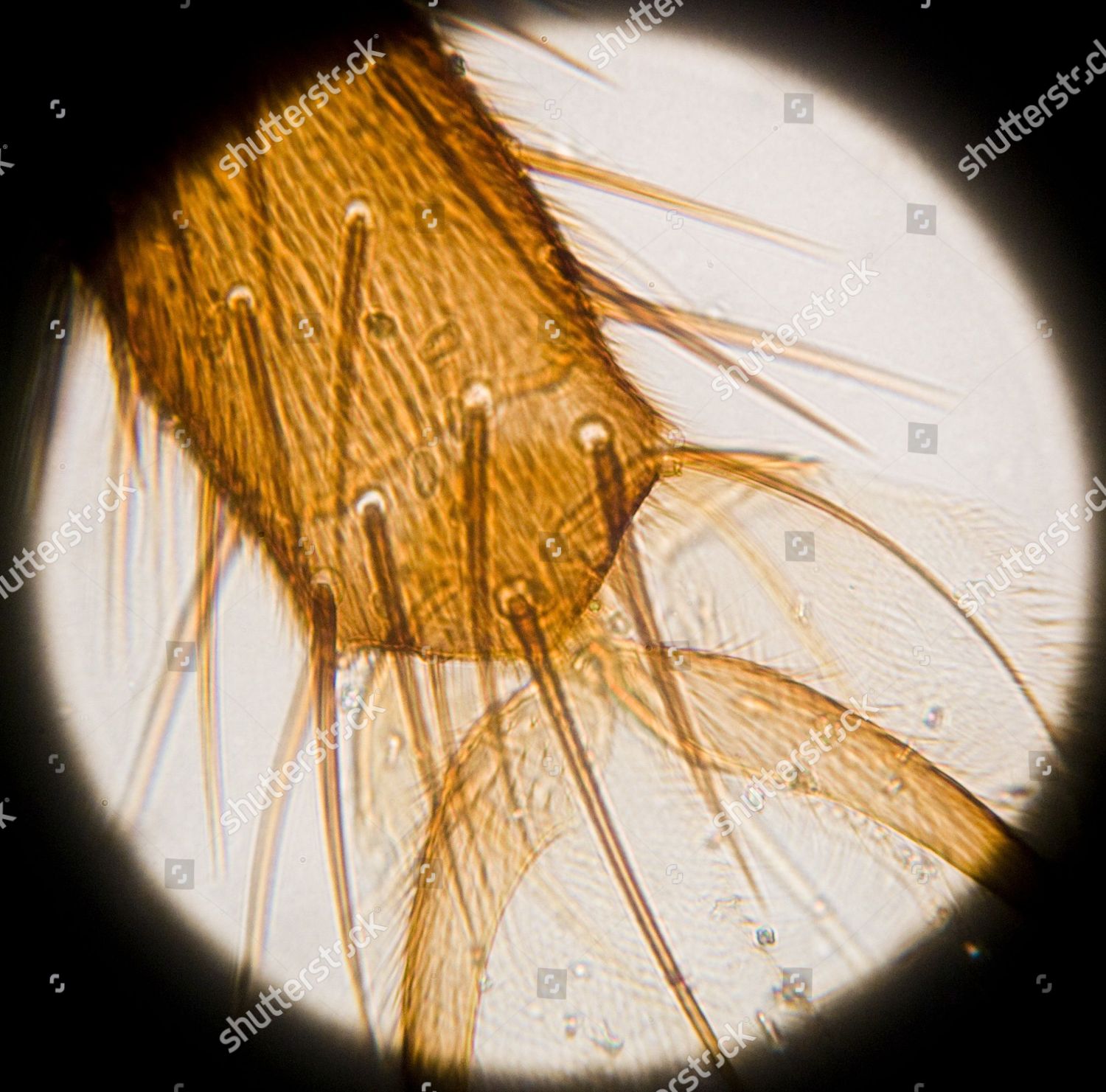Housefly Leg Magnification X 400 Editorial Stock Photo - Stock Image ...