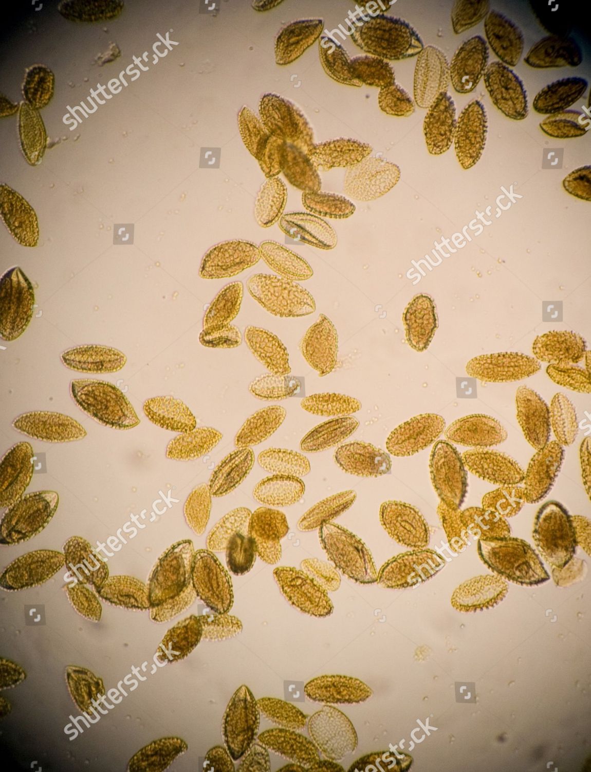 Pollen Grains Lilly Valley Magnification X Editorial Stock Photo ...