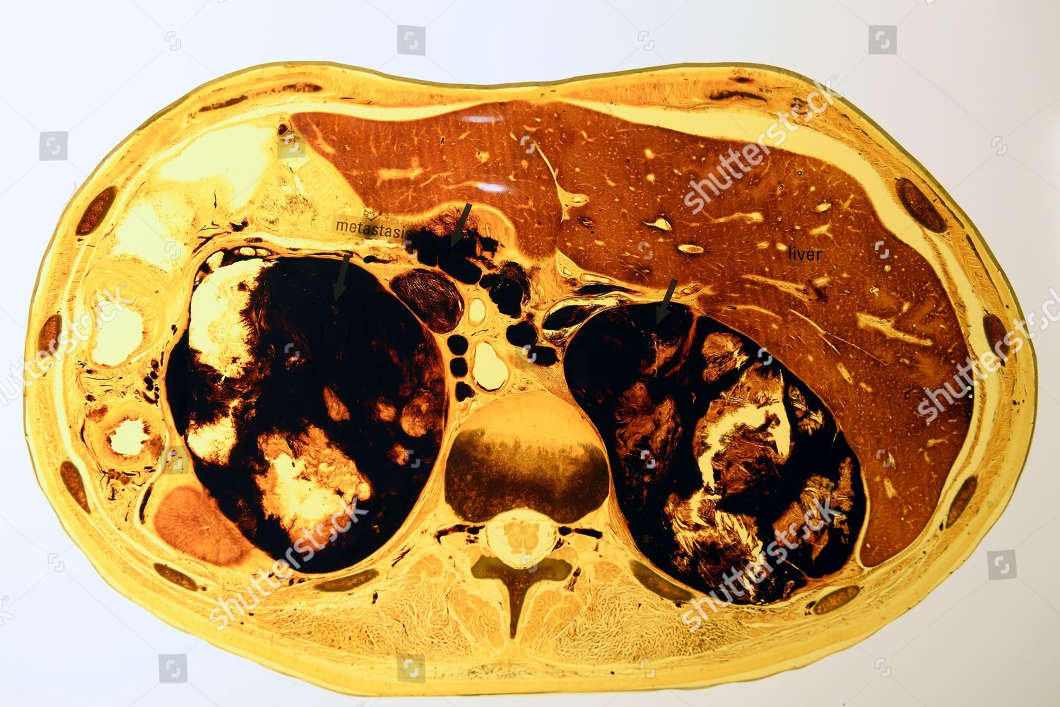 Plastinate Cross Section Human Abdomen Skin Editorial Stock Photo ...