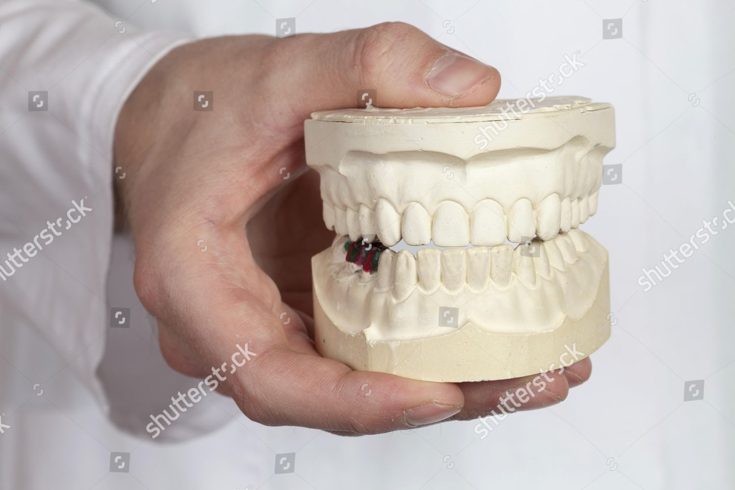 Model Released Hand Holding Plaster Model Editorial Stock Photo - Stock ...