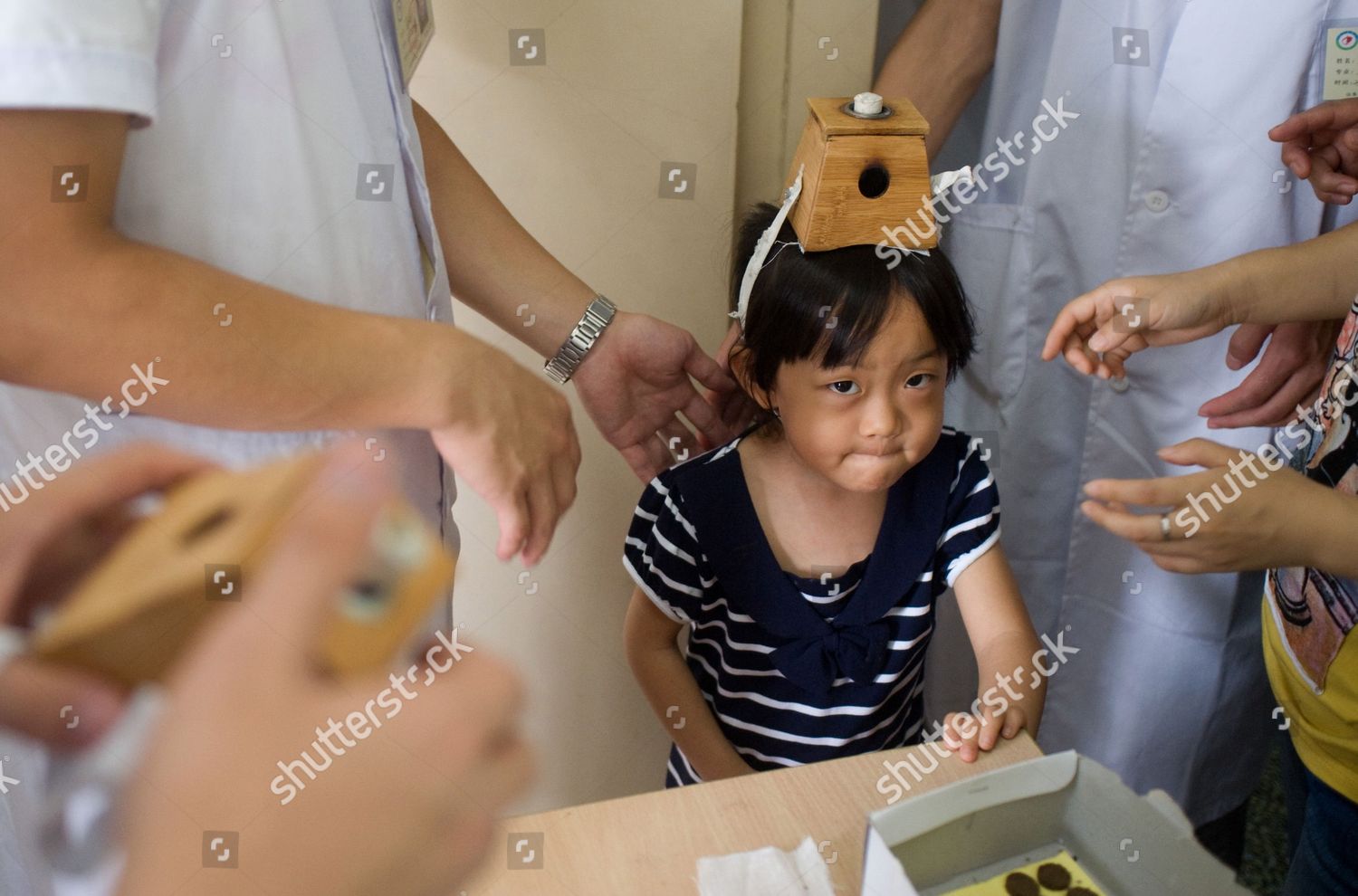 MOXIBUSTION BOX FIXED ON GIRL'S HEAD Editorial Stock Photo - Stock ...